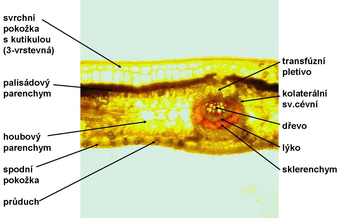 Příčný řez různostranným listem fíkovníku pryžodárného příprava preparátu