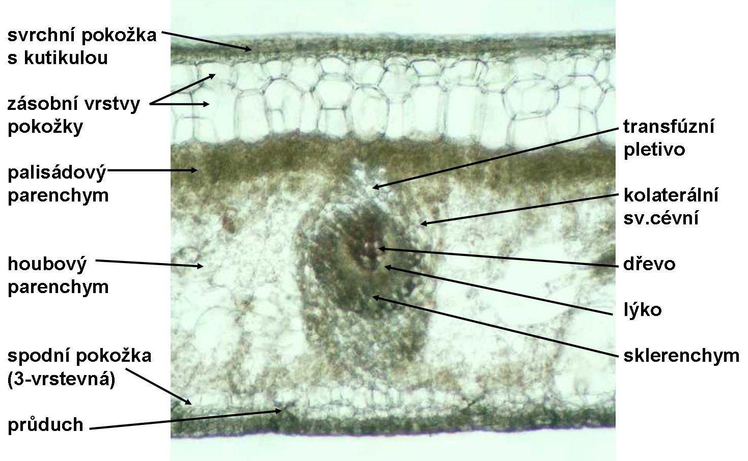 Příčný řez různostranným listem fíkovníku pryžodárného příprava preparátu