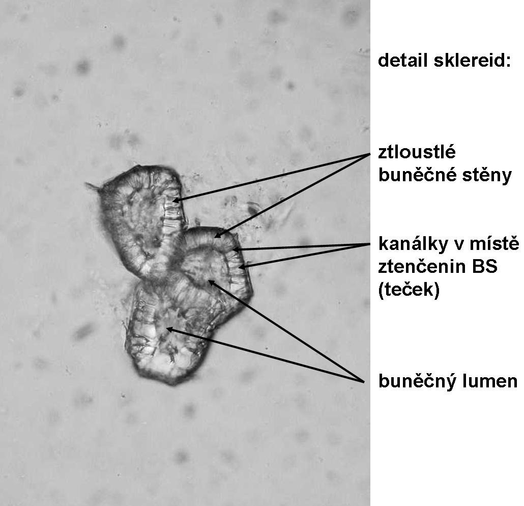 Sklerenchym z dužniny malvice hrušně obecné příprava preparátu
