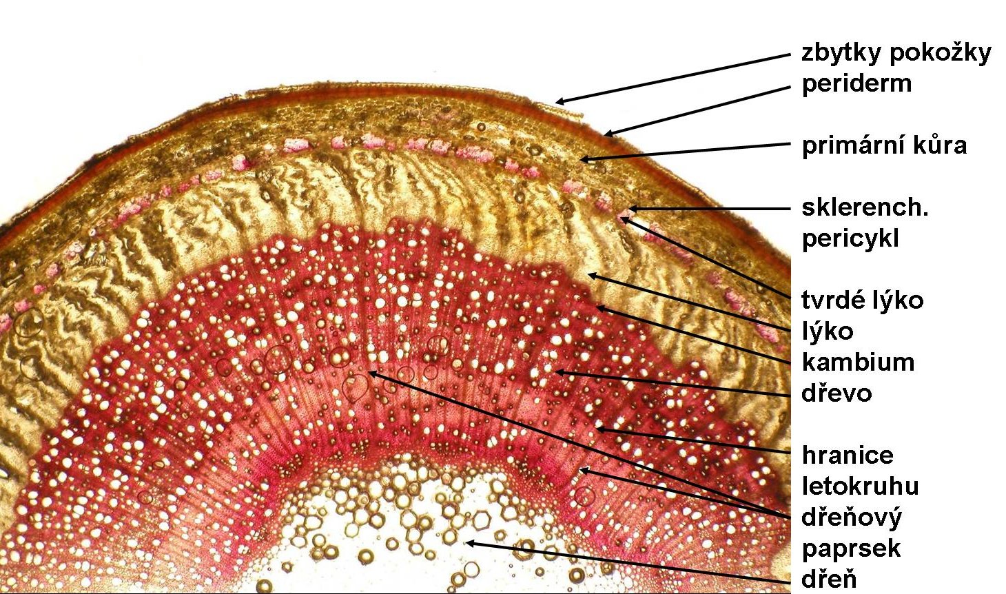 Příčný řez víceletou větvičkou borovice příprava preparátu