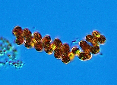 2 kmen CYANOPHYTA - sinice