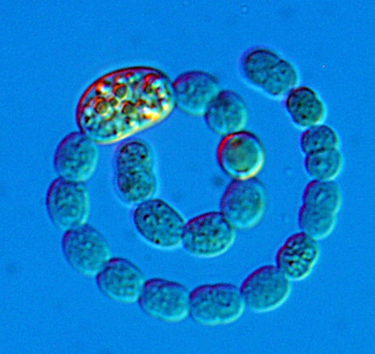 2 kmen CYANOPHYTA - sinice