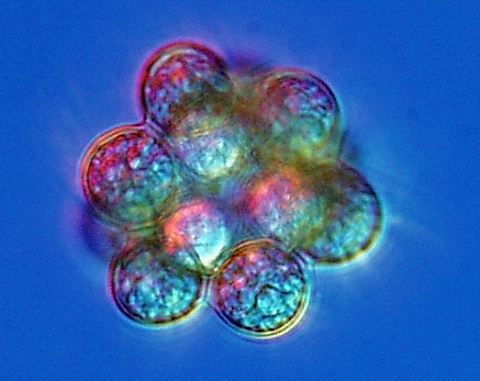 5. kmen CHLOROPHYTA - zelené řasy