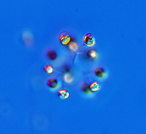 5. kmen CHLOROPHYTA - zelené řasy