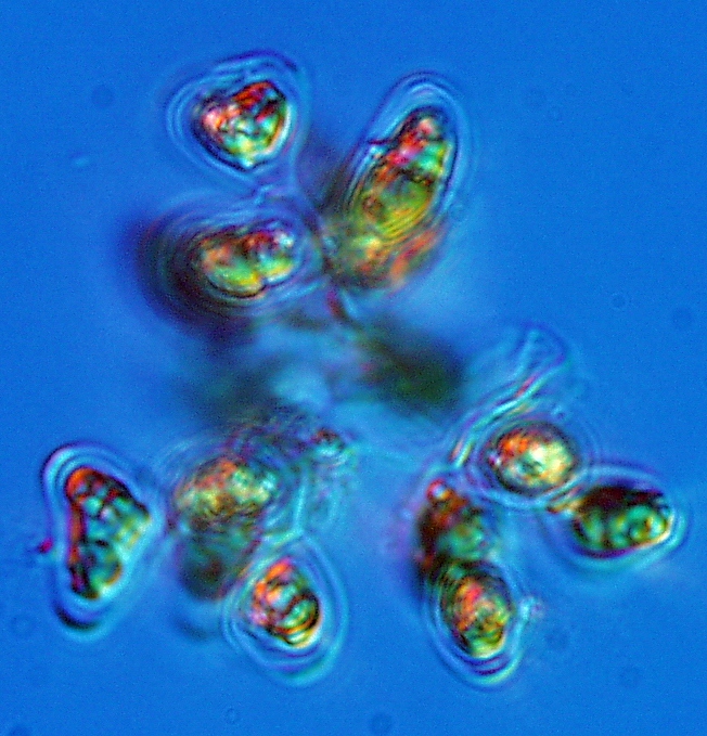 5. kmen CHLOROPHYTA - zelené řasy