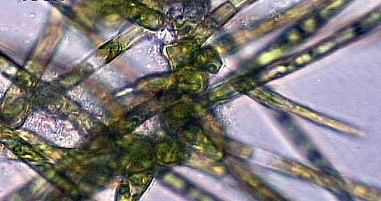 5. kmen CHLOROPHYTA - zelené řasy