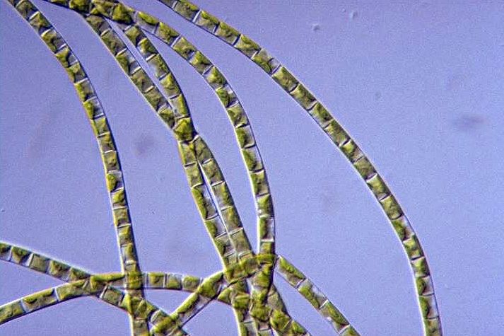 5. kmen CHLOROPHYTA - zelené řasy